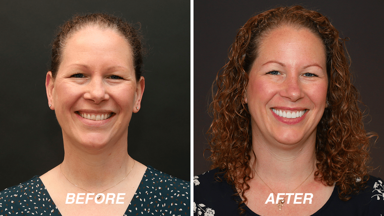 Smile Design Woburn | Smile Design Dentistry Winchester | Dr. Clancy