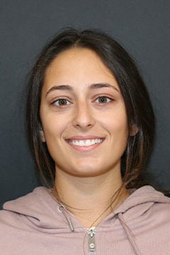 Before & After Myofunctional Therapy in Woburn, MA | Haley Testimonial