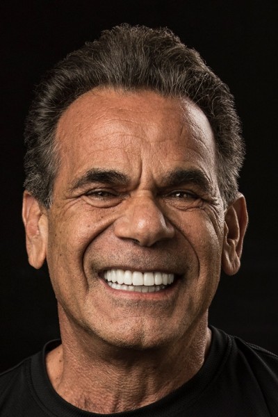 Before & After TMJ Treatment in Woburn, MA | Tony Testimonial